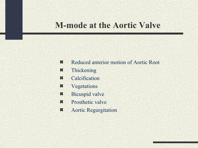 M mode echocardiography | PPT | Heart and Cardiovascular Diseases ...