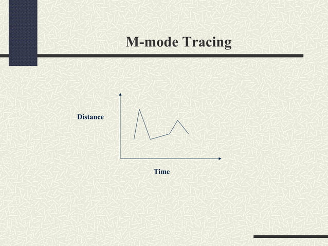 M mode echocardiography | PPT | Heart and Cardiovascular Diseases ...