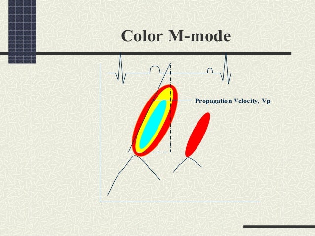 M mode echocardiography