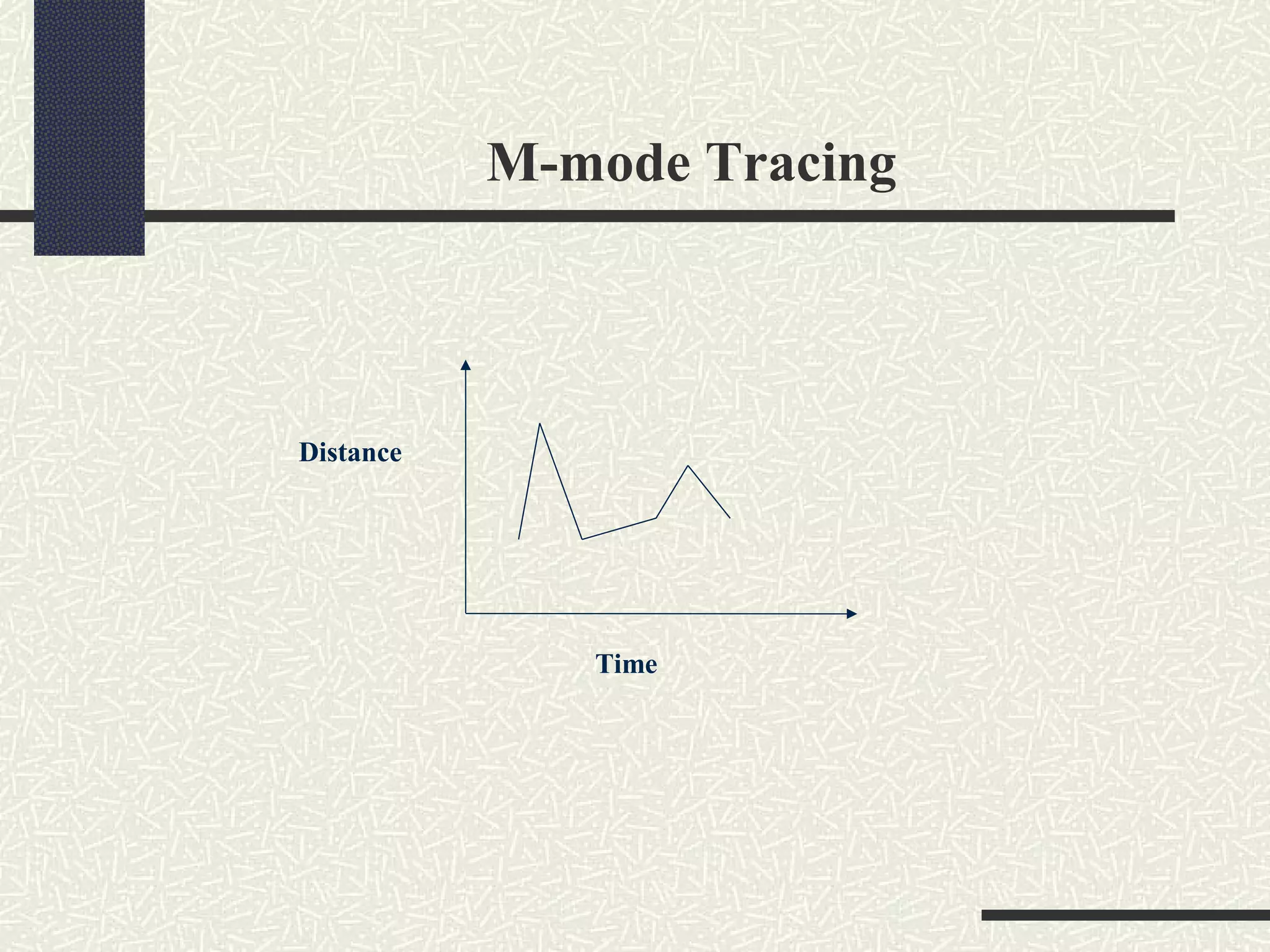 M mode echocardiography | PPT