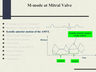 M mode echocardiography | PPT