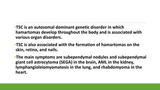 M-TOR in Management of Renal Angiolipomyoma | PPTX
