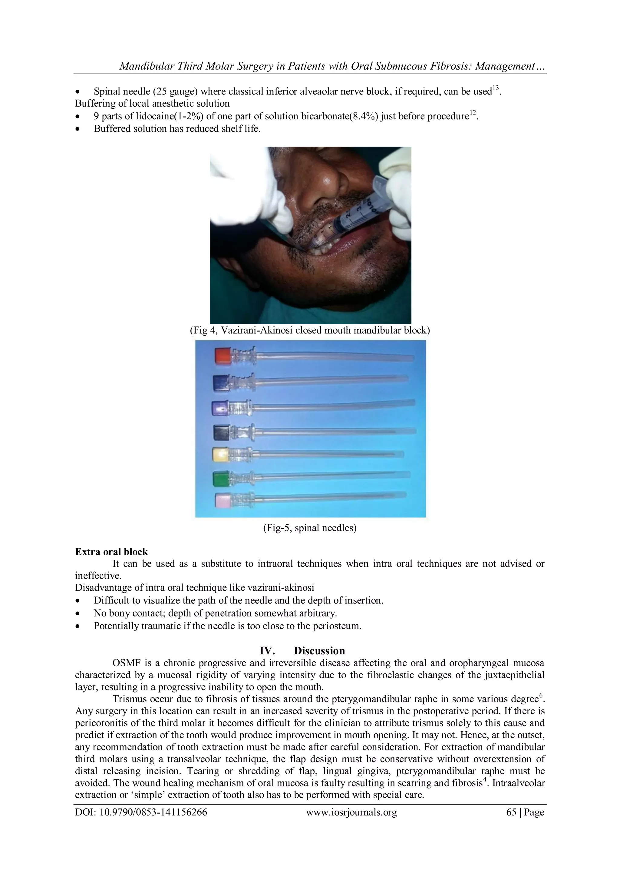Mandibular Third Molar Surgery in Patients with Oral Submucous Fibrosis ...