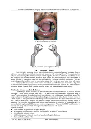 Mandibular Third Molar Surgery in Patients with Oral Submucous Fibrosis ...