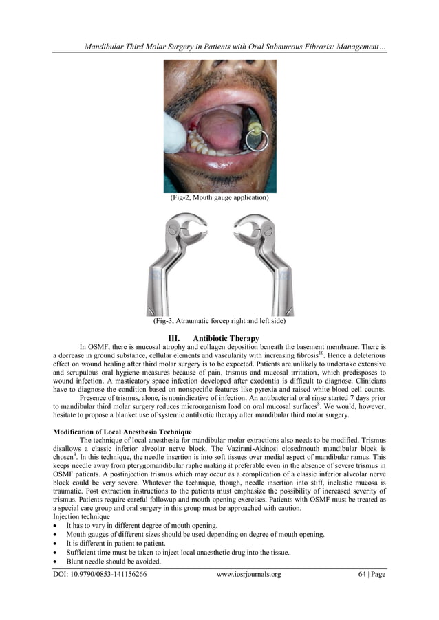 Mandibular Third Molar Surgery in Patients with Oral Submucous Fibrosis ...