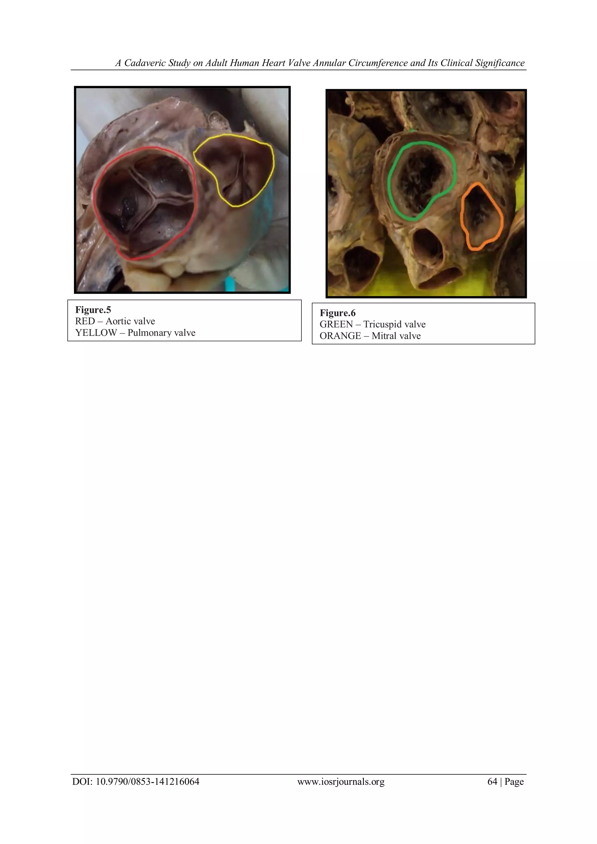 A Cadaveric Study on Adult Human Heart Valve Annular Circumference and ...
