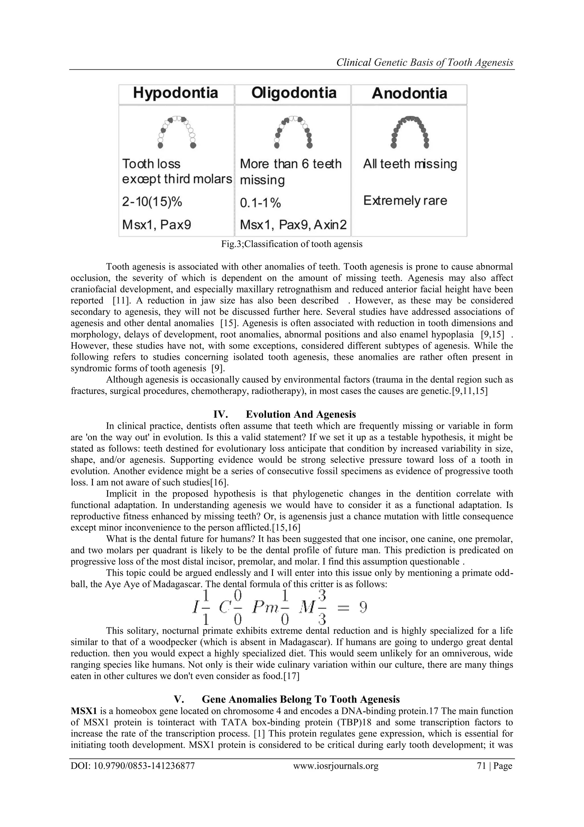 Clinical Genetic Basis of Tooth Agenesis | PDF