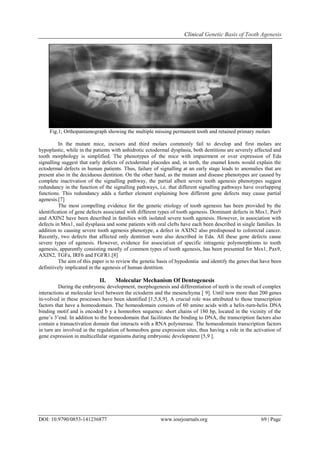 Clinical Genetic Basis of Tooth Agenesis | PDF