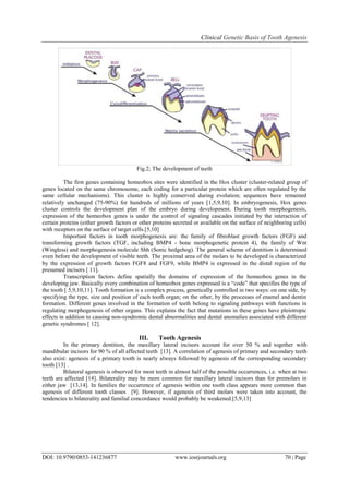 Clinical Genetic Basis of Tooth Agenesis | PDF