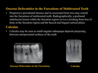 M0302. principles of radigraphic interpretation. 2.pdf