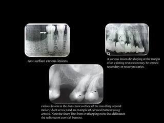 M0302. principles of radigraphic interpretation. 2.pdf