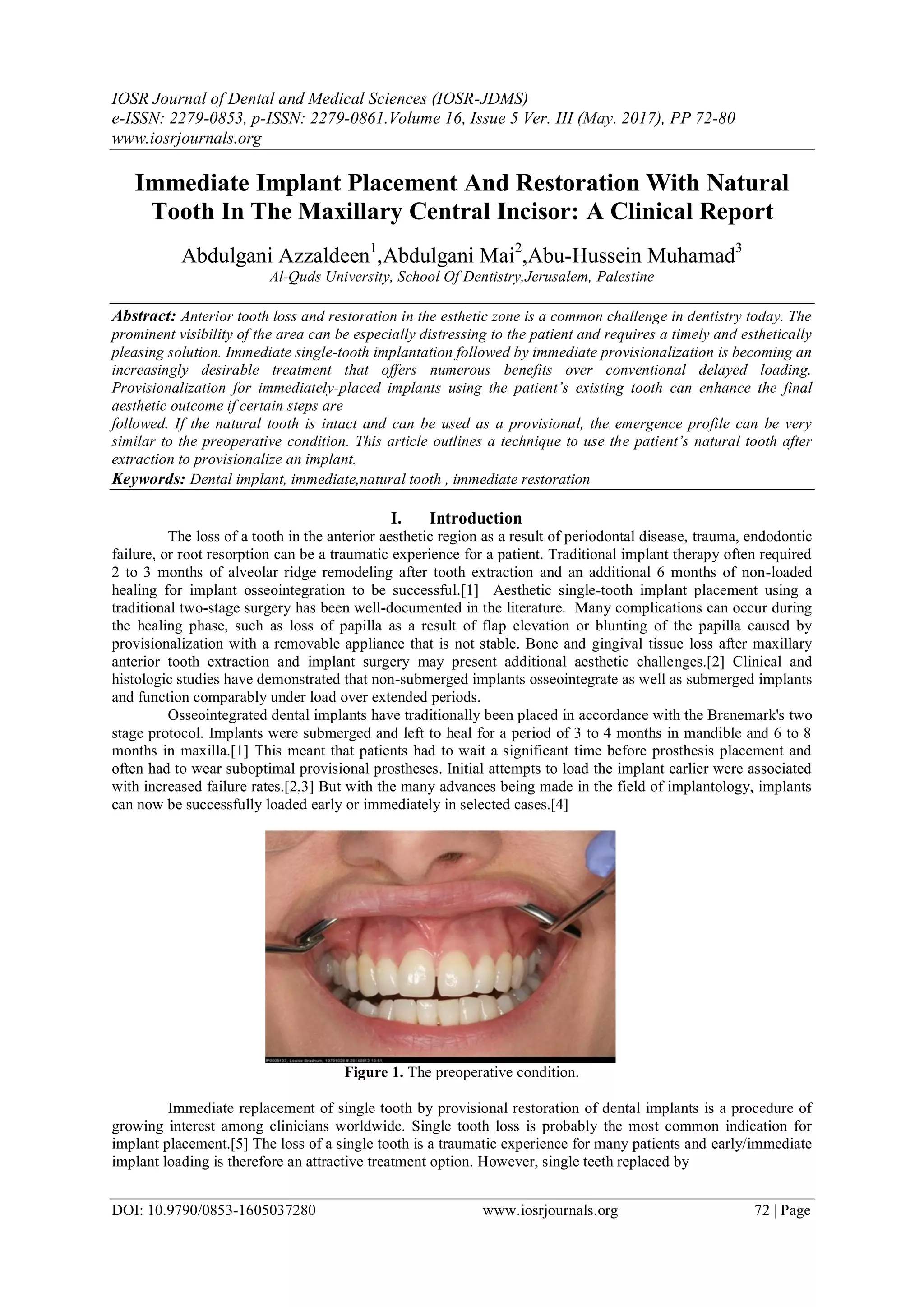 Immediate Implant Placement And Restoration With Natural Tooth In The Maxillary Central Incisor ...