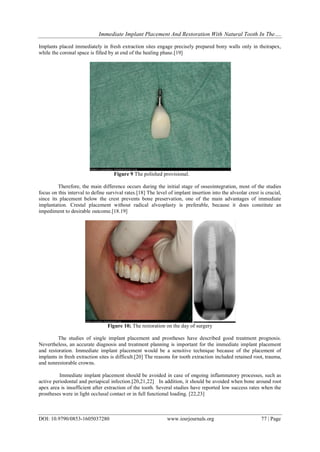 Immediate Implant Placement And Restoration With Natural Tooth In The Maxillary Central Incisor ...