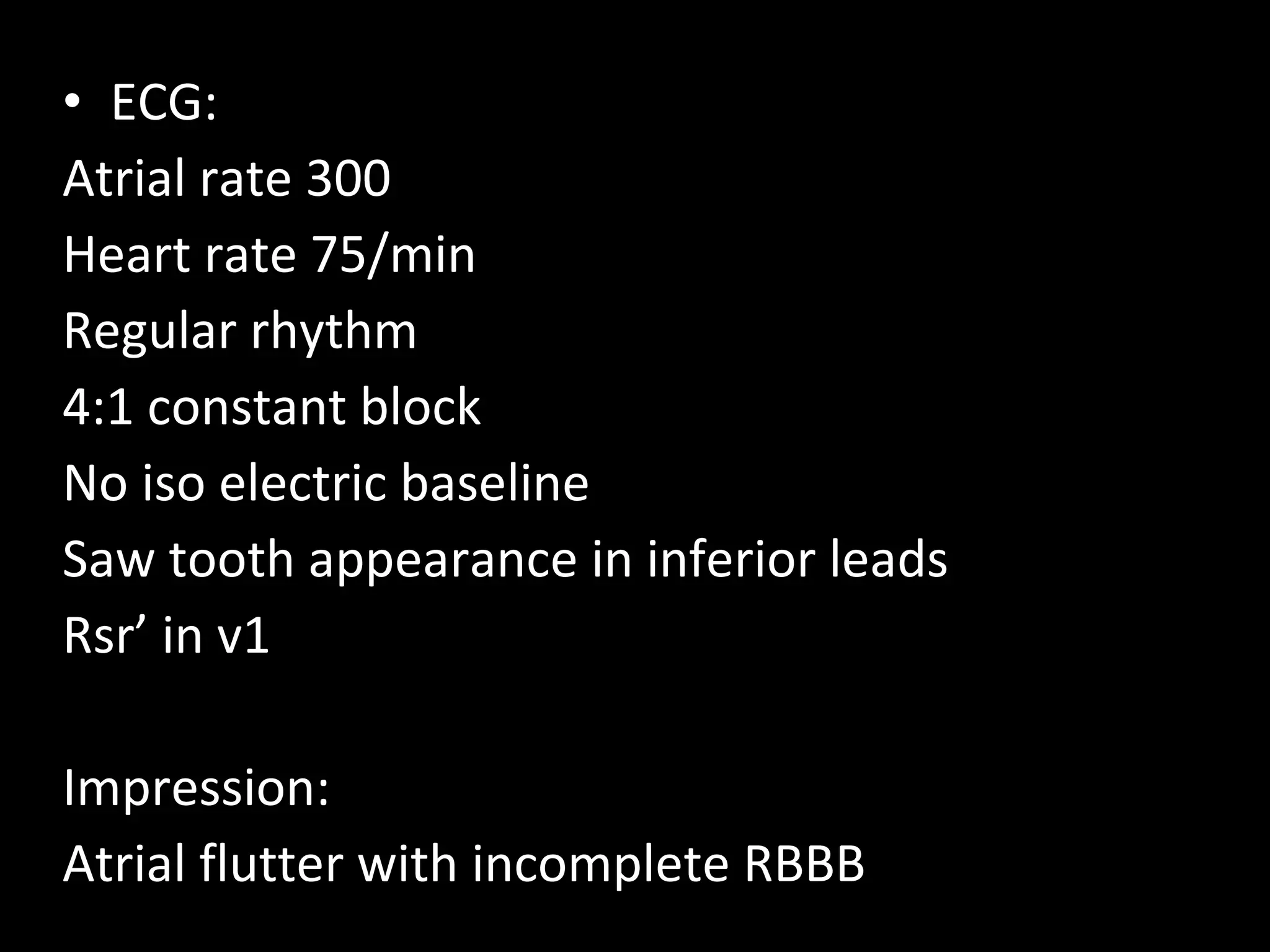ECG: Atrial Flutter | PPT