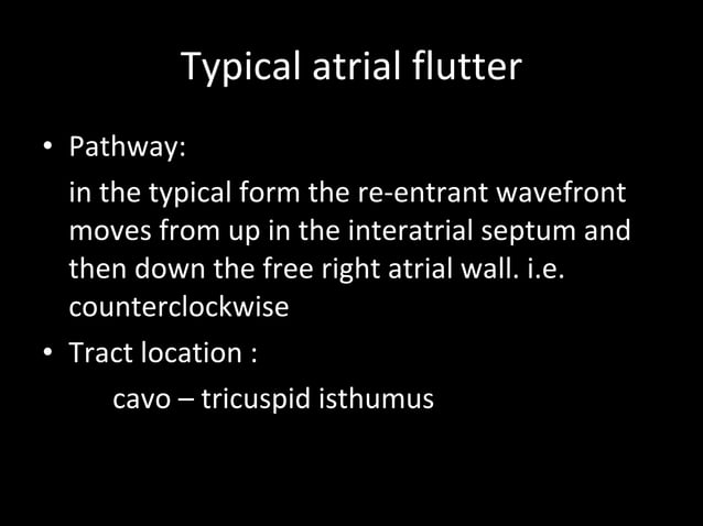ECG: Atrial Flutter | PPT