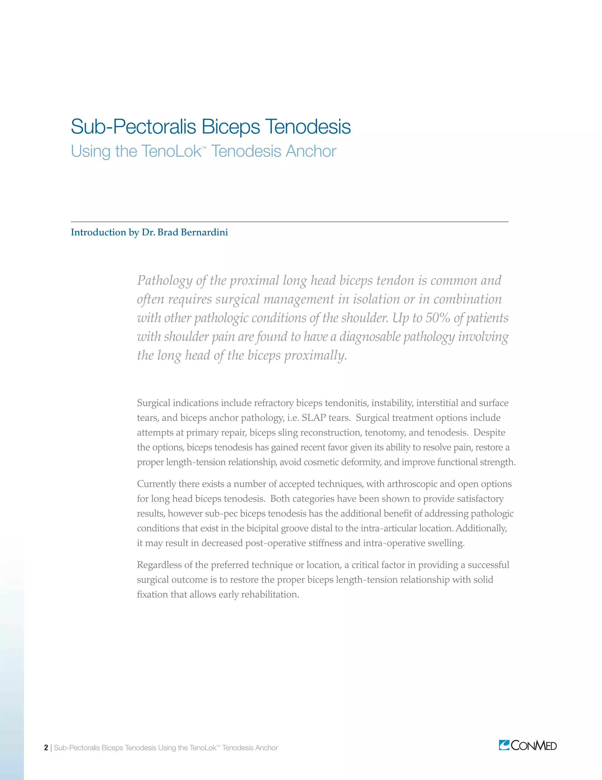 Brad Bernardini, MD: Sub-Pectoralis Biceps Tenodesis Using the TenoLok ...