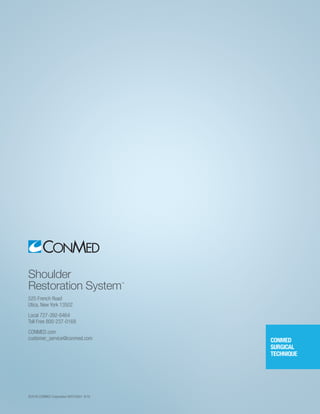 Brad Bernardini, MD: Sub-Pectoralis Biceps Tenodesis Using the TenoLok ...