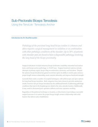 Brad Bernardini, MD: Sub-Pectoralis Biceps Tenodesis Using the TenoLok ...
