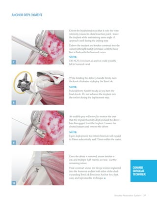Brad Bernardini, MD: Sub-Pectoralis Biceps Tenodesis Using the TenoLok ...