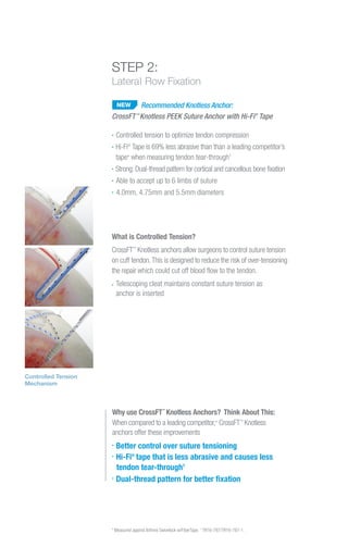 CuffLink™ Double-Row Solution - Less Abrasion, Less Unplanned Tension | PDF