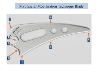 IASTM: M2T blade | PDF