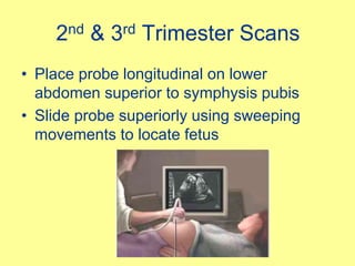 m3_h._gee_-_2nd_and_3rd_tri_scanning_technique.ppt