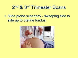 m3_h._gee_-_2nd_and_3rd_tri_scanning_technique.ppt