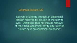 _M3S1 Doc Duncan ( MT - Cesarean Section ) Lect 4 @part 2 Oct 21.pptx