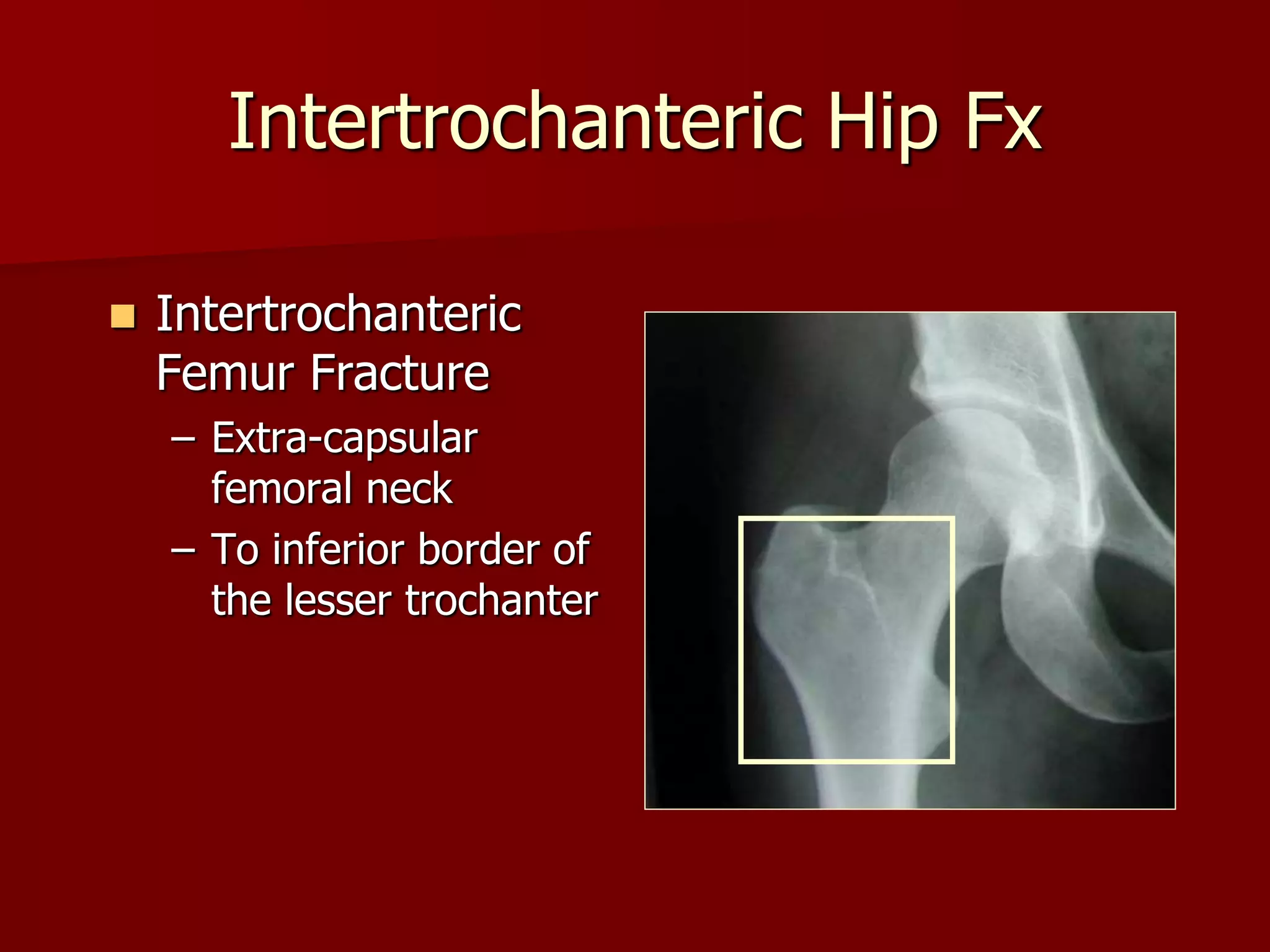 Lower extremity | PPT