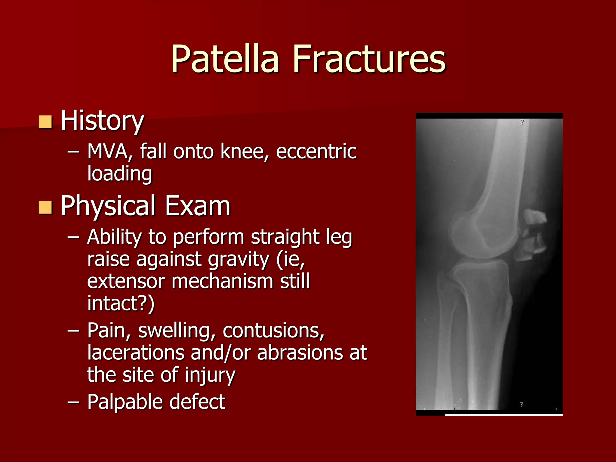Lower extremity | PPT