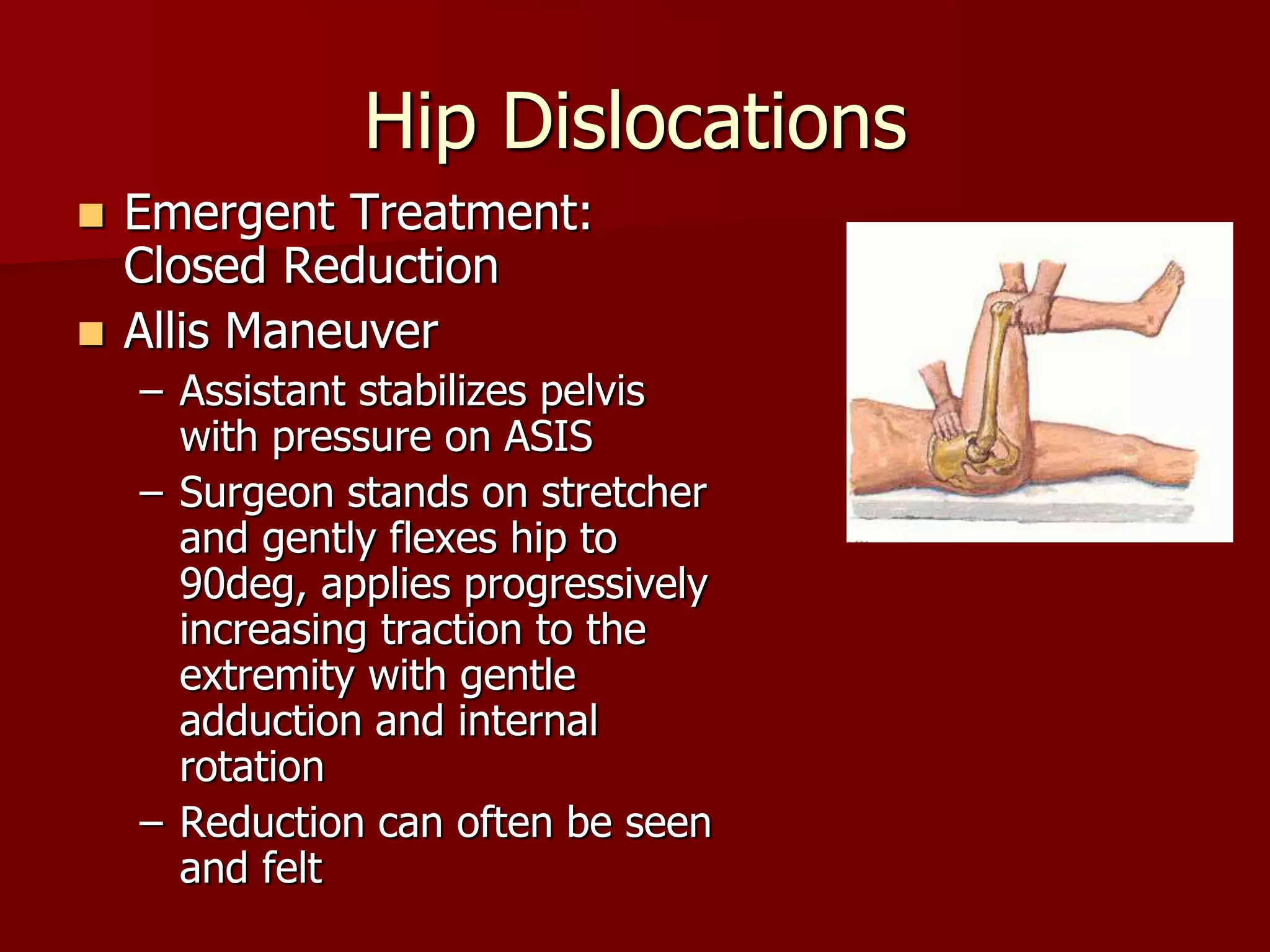 Lower extremity | PPT