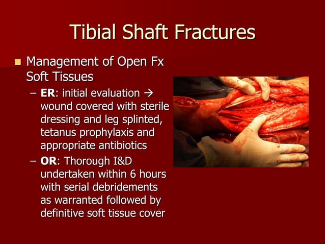 Lower extremity | PPT