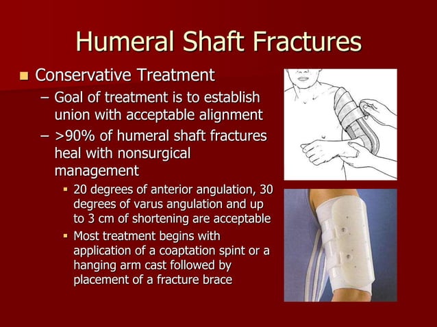 m4-lecture-3-upper-extremity trauma PPTx | PPT