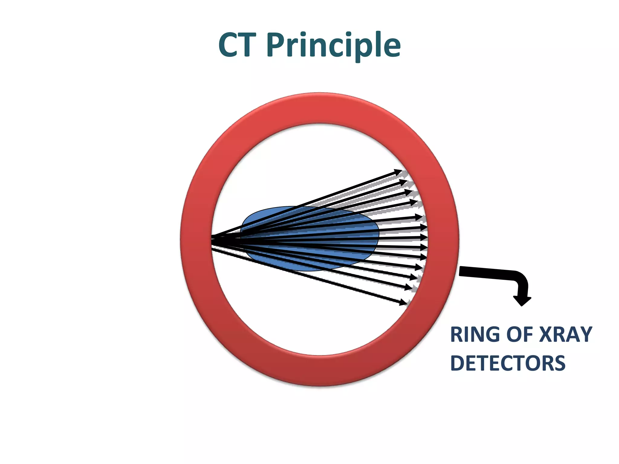 CT Scan - Basics | PPT