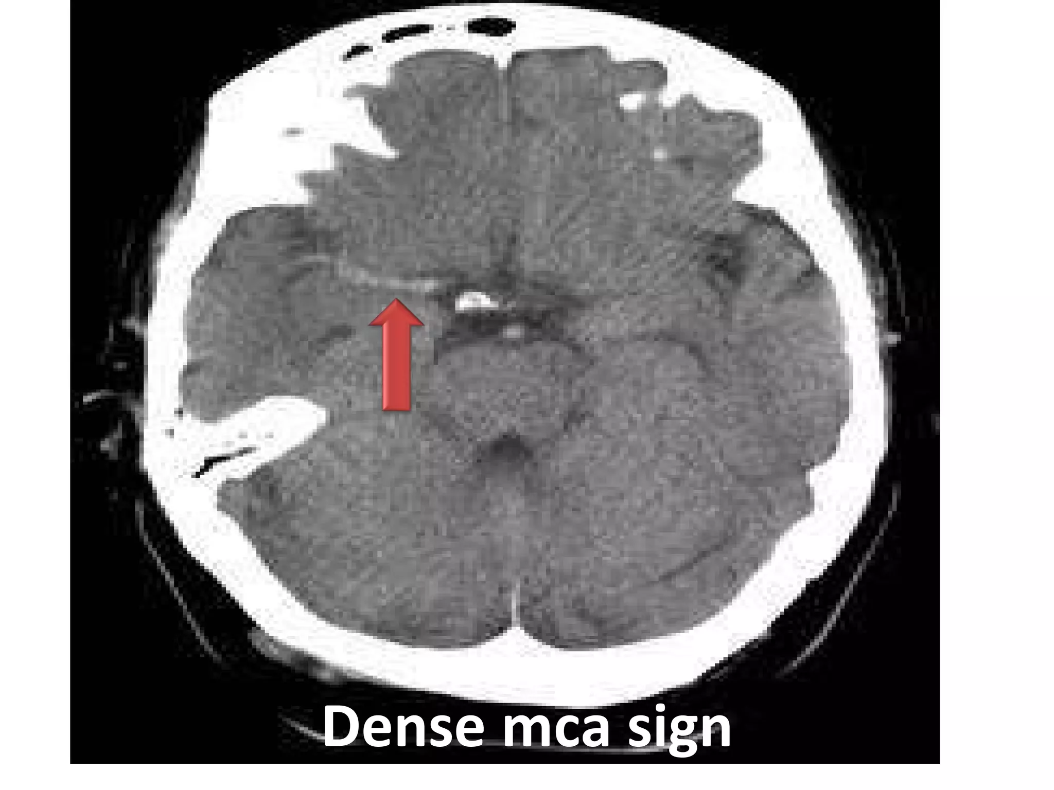 CT Scan - Basics | PPT