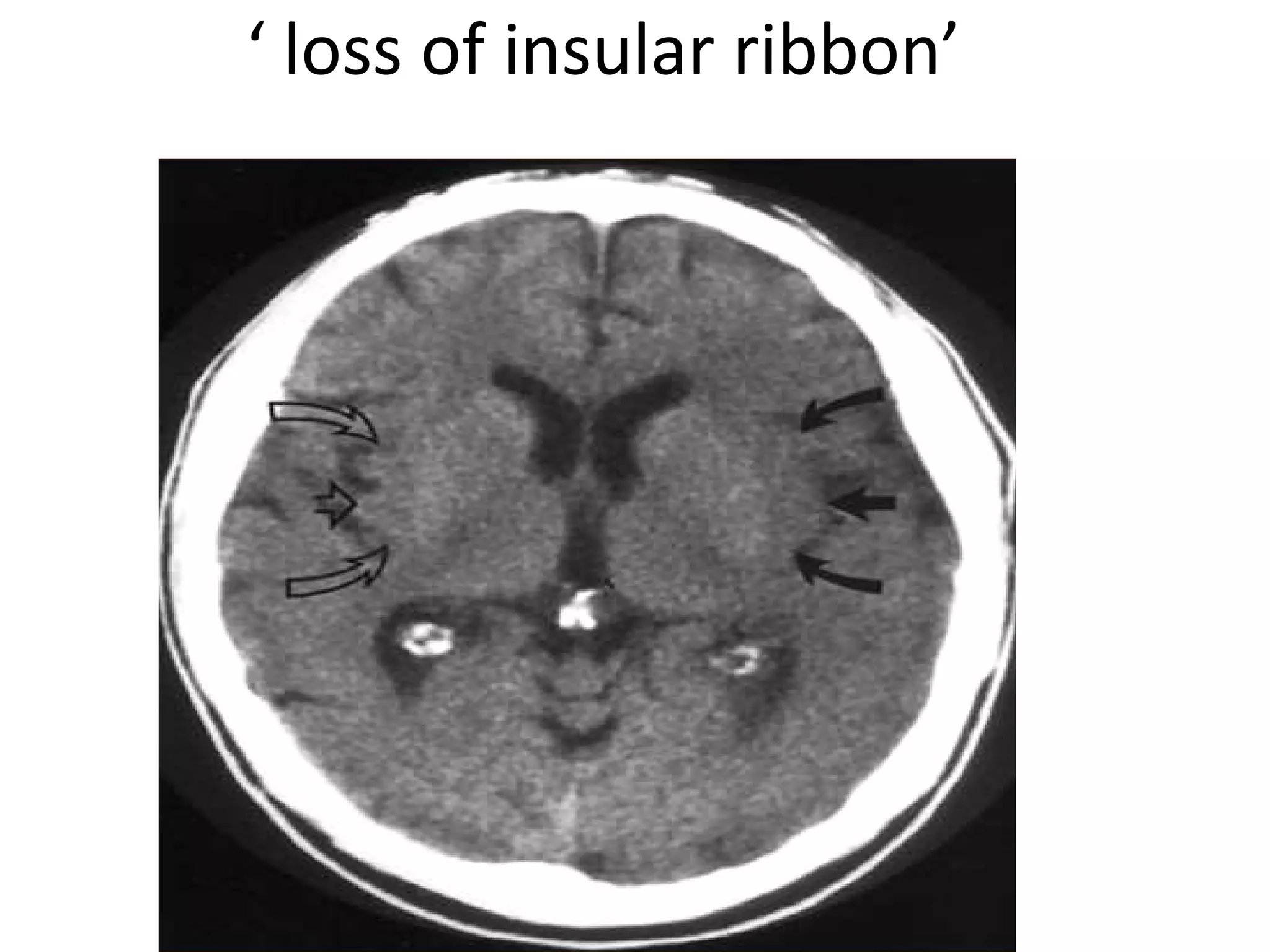 CT Scan - Basics | PPT