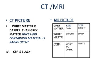 CT Scan - Basics | PPT