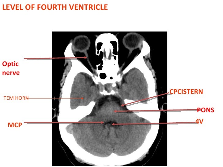 CT Scan - Basics