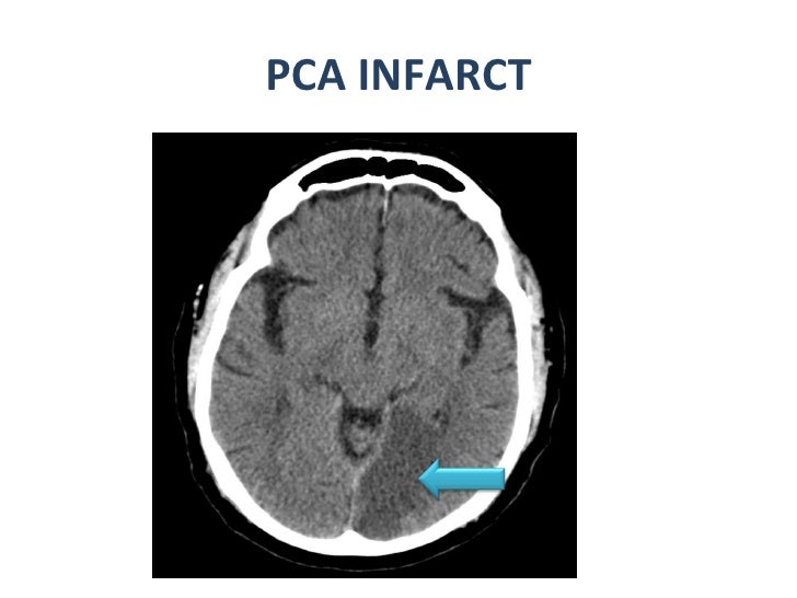CT Scan - Basics