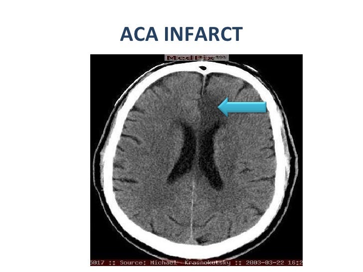 CT Scan - Basics
