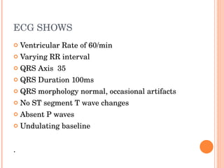 ECG: New onset AF with slow ventricular response | PPT