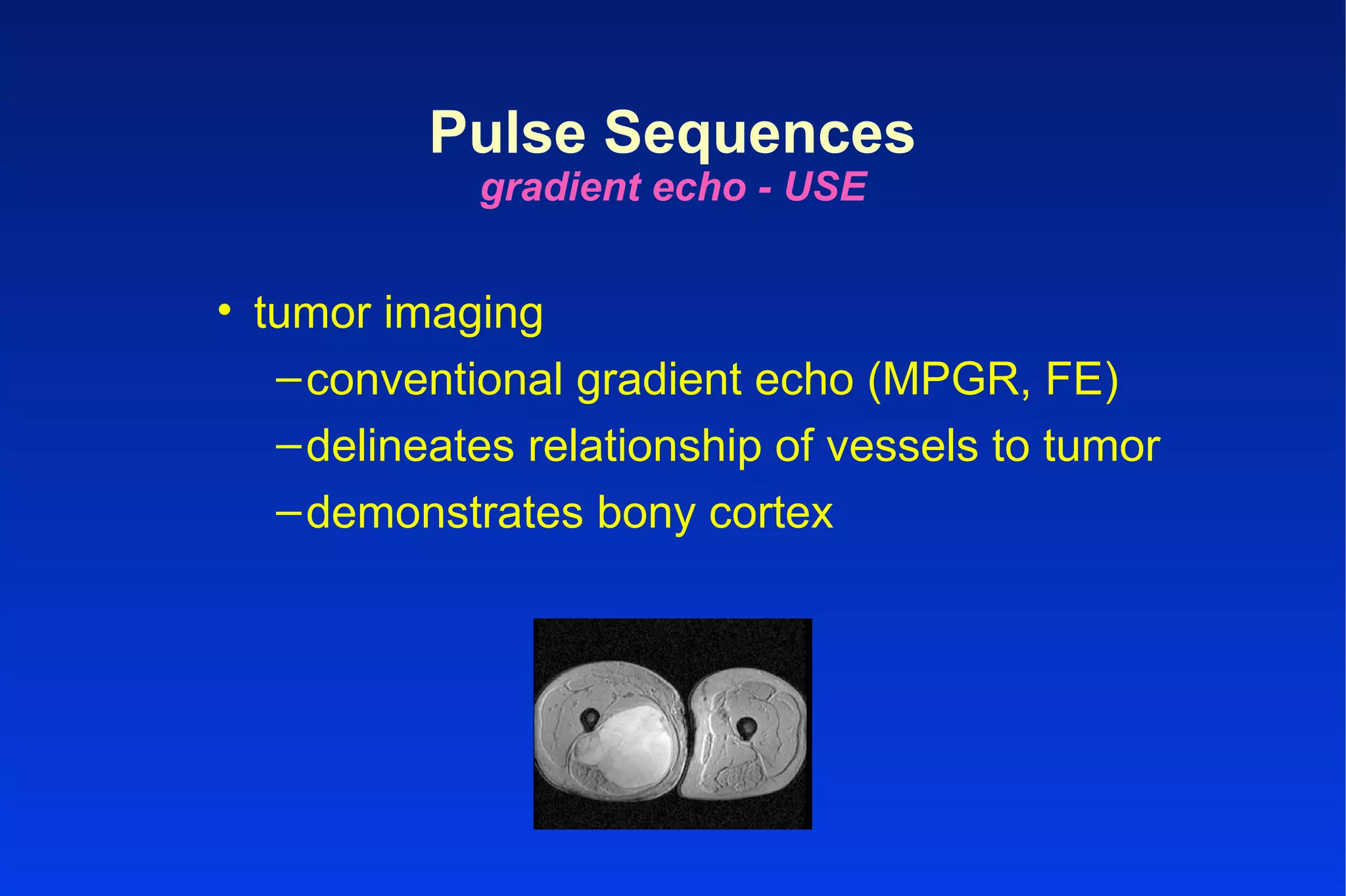 Pulse sequences gradient echo | PPT