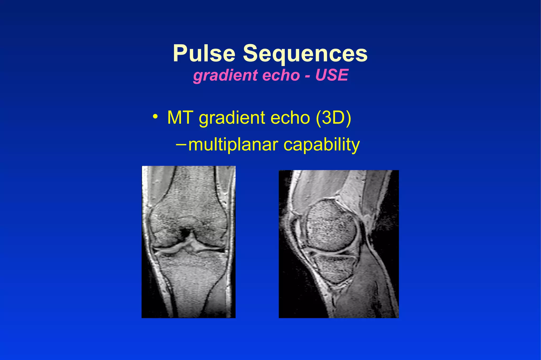 Pulse sequences gradient echo | PPT