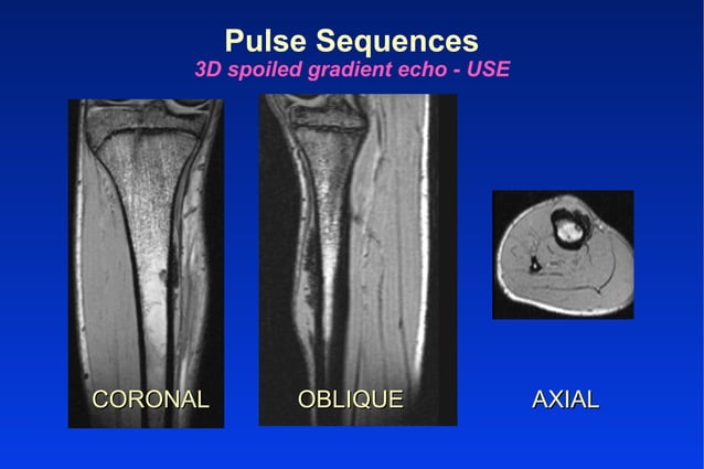 Pulse sequences gradient echo | PPT