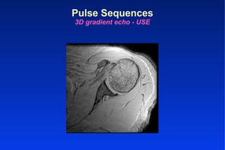 Pulse sequences gradient echo | PPT
