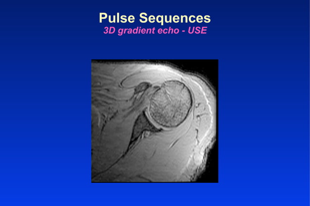 Pulse sequences gradient echo | PPT