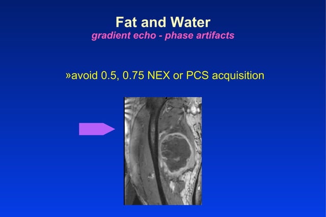 Pulse sequences gradient echo | PPT