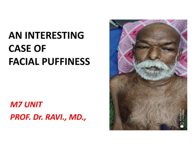 M7 - An Interesting case of Facial Puffiness.pptx
