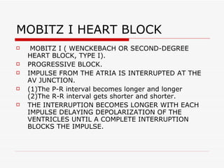 ECG: Conduction Block | PPT