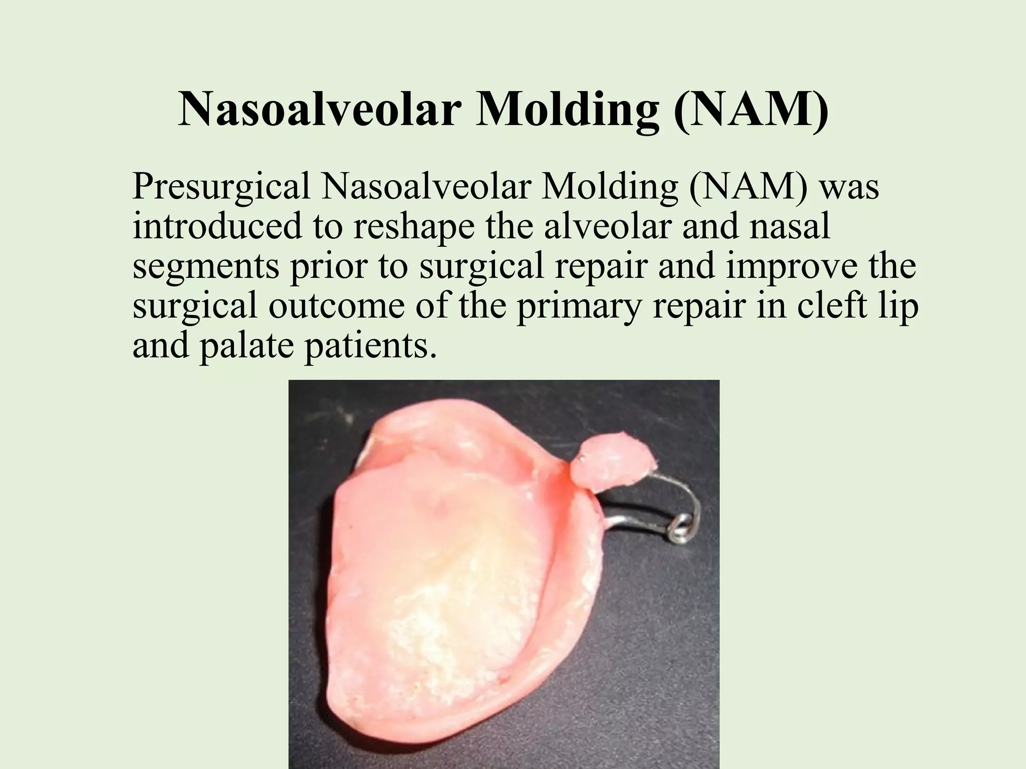 NASOALVEOLAR MOULDING AND PEDODONTIST | PPT